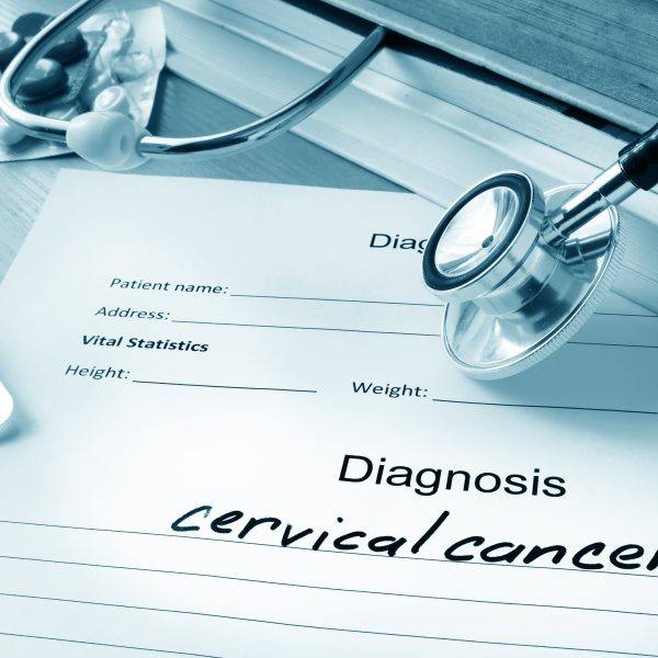 My Cervical Cancer Journey - Guest Post by Kelly Creager